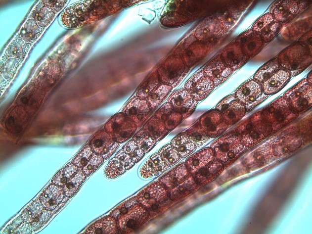 Red Algae Under Microscope